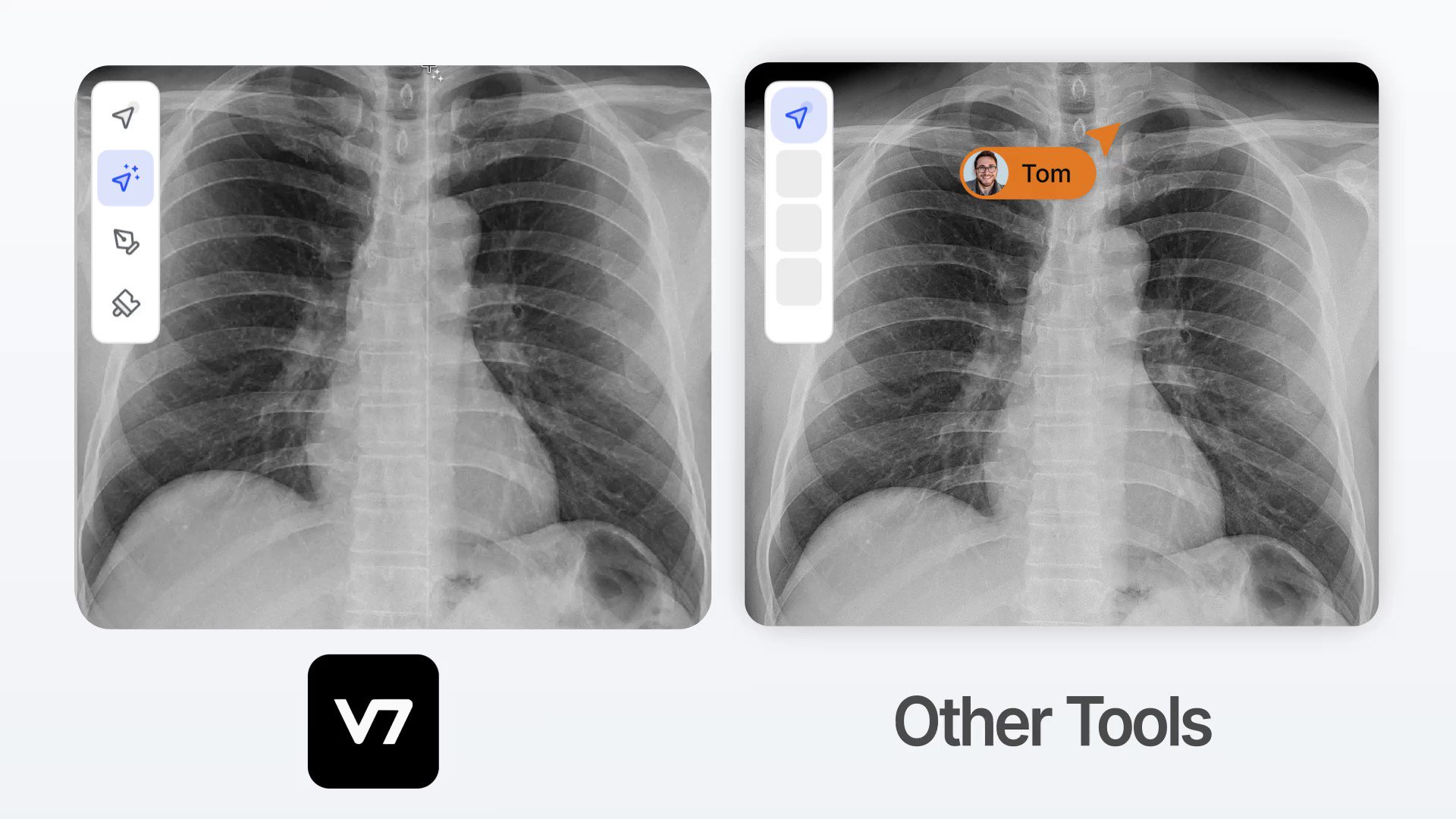 V7 on Twitter: "Label DICOM and NIfTI files 10x faster with V7. Train and deploy accurate, FDA ...