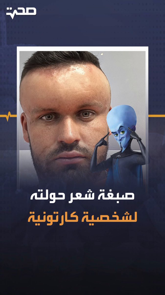 العربية صحة | رأس رجل يصبح بحجم شخصية الرسوم المتحركة ميجامايند بعد ...