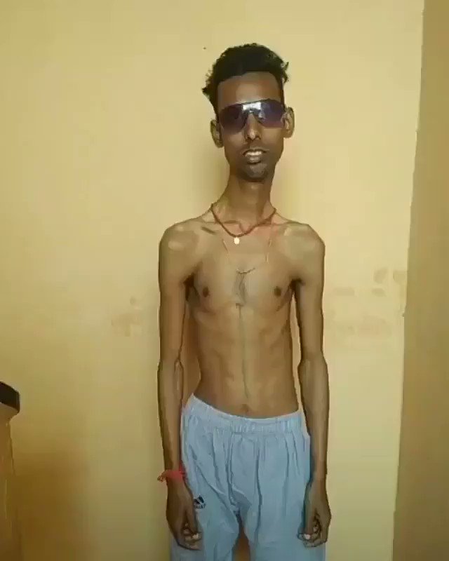 The Skinniest Boy In The World