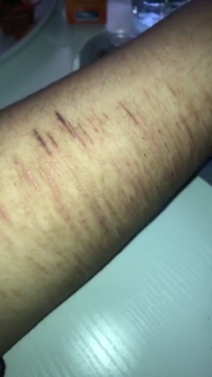 Cut Arm With Blade