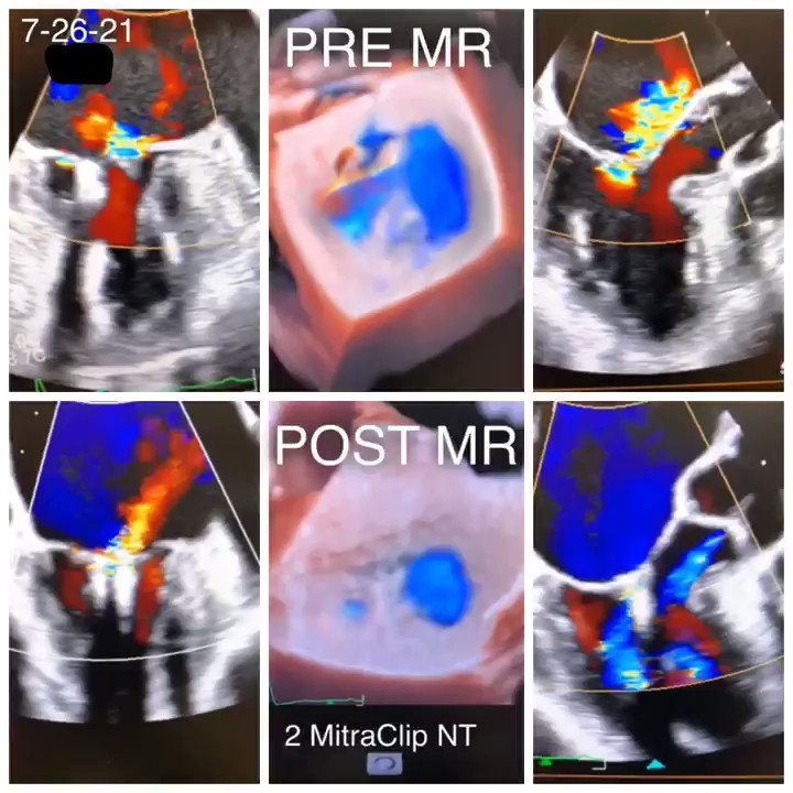Baylor Med Adv Heart Failure & Structural Heart (@BCMAdvStrlHeart) / Twitter