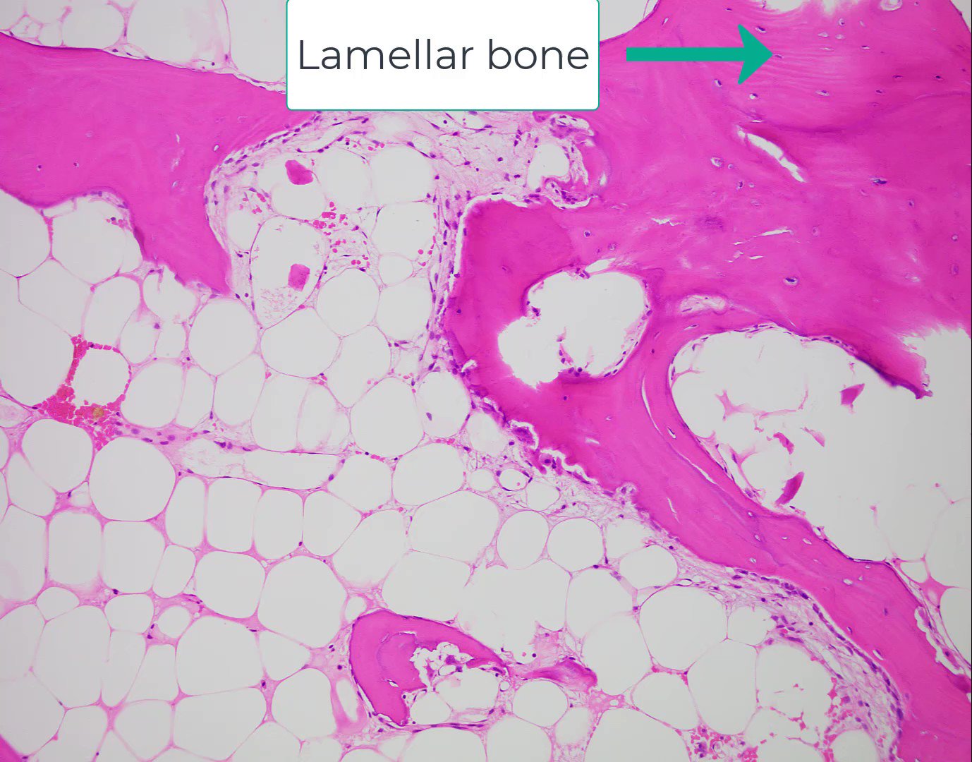 Lamellar Bone Histology