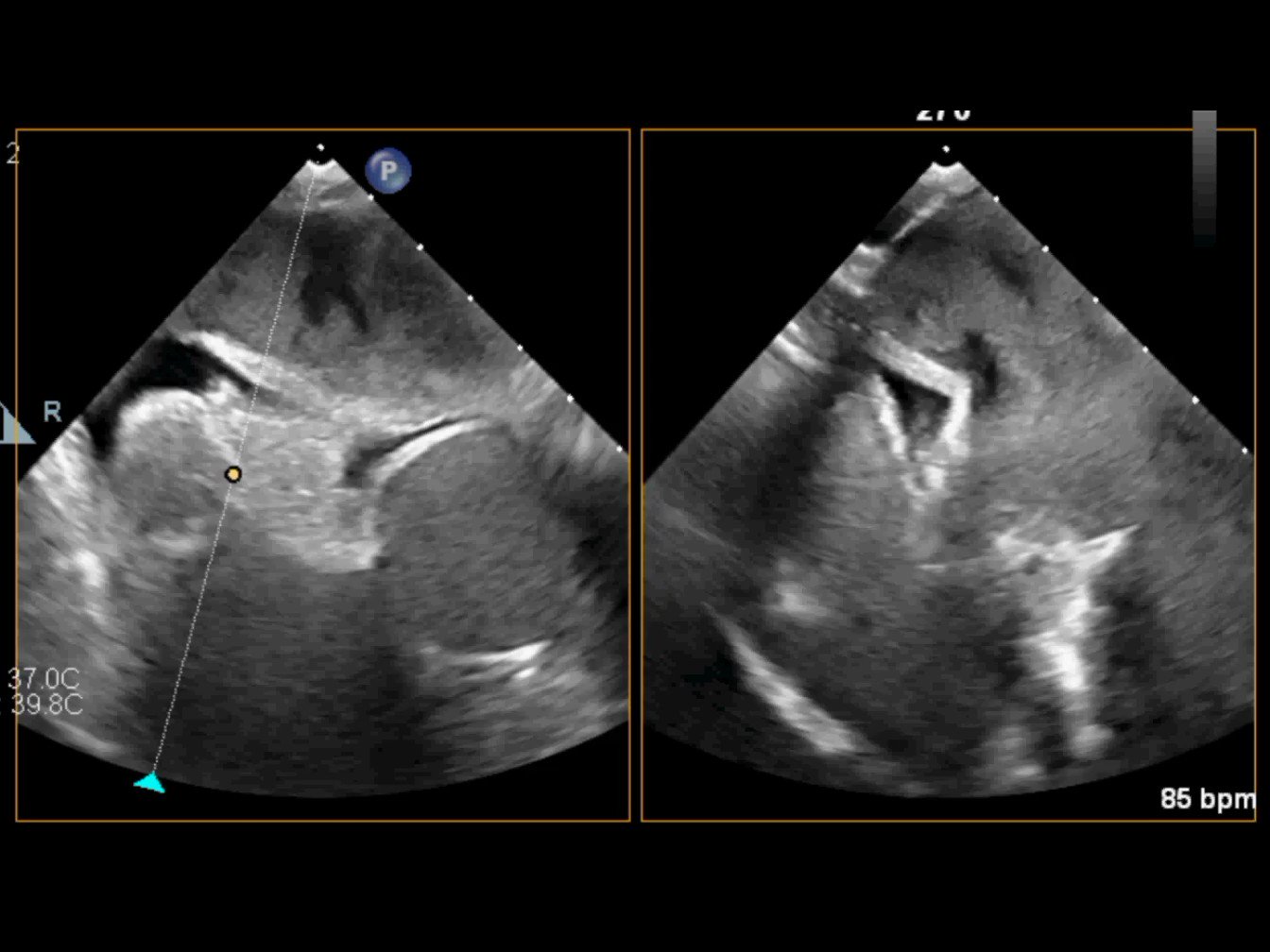 European Society Of Cardiology On Twitter Rt Esc Journals