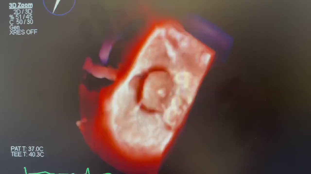 Baylor Med Adv Heart Failure & Structural Heart (@BCMAdvStrlHeart) / Twitter