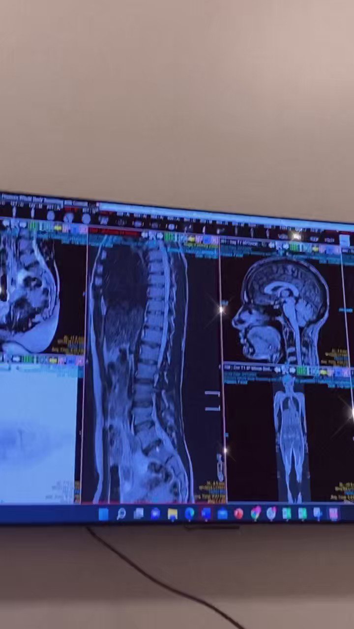 parishilton-on-twitter-i-went-to-prenuvo-to-get-a-full-body-scan-i
