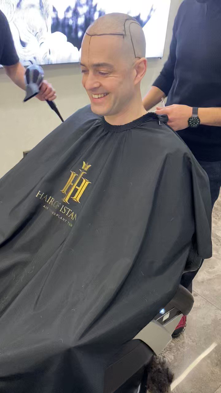 Lee Mead on Twitter: "Hair today gone tomorrow 😄 #Istanbul #HairTransplant https://t.co ...