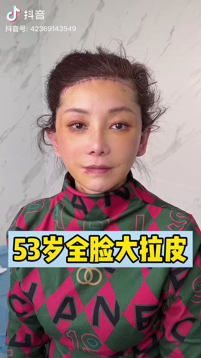 ファックパッカーごみむし@ハンガリー On Twitter 若い女性といつまでもセックスをするためにこれを検討しなくてはいけない この技術と勃起薬さえあれば死ぬまでちんちんをまんまんに