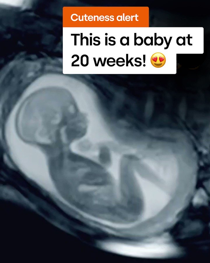 20 Weeks Pregnant Baby