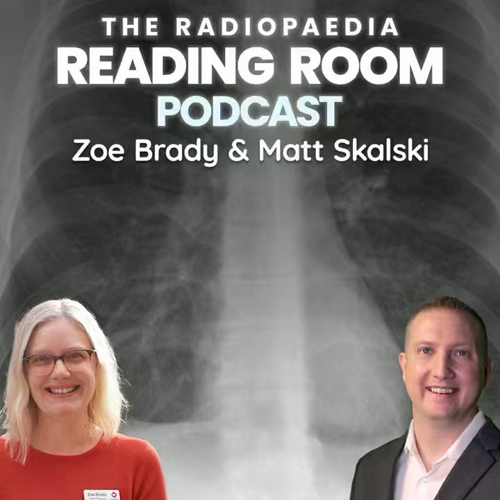 Radiology Signs on Twitter: "RT @Radiopaedia: This week on the podcast ...