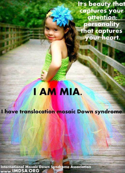 Mosaicism Down Syndrome