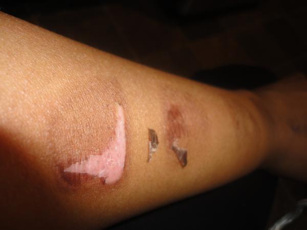 Salt And Ice Challenge