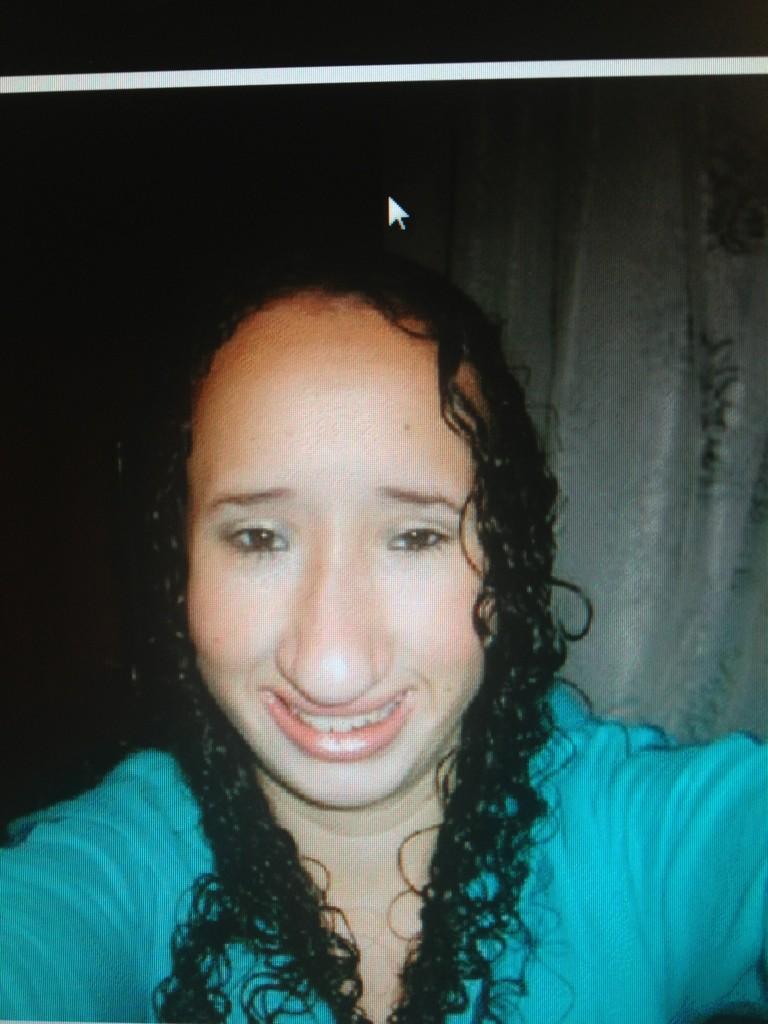 Leona Lewis Nose Job Before And After