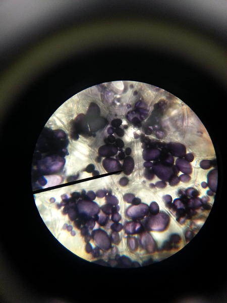 Potato Under Microscope
