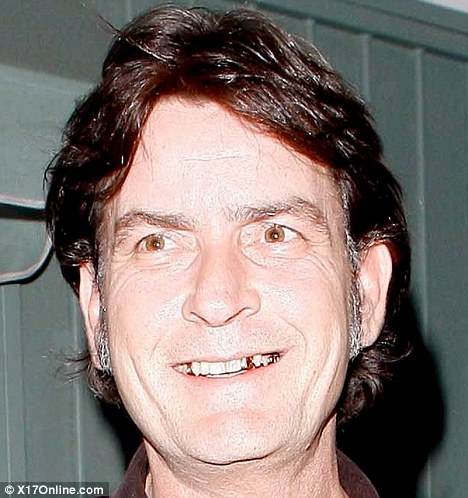 Charlie Sheen Gross Teeth The Charlie Sheen Guide To Winning! At