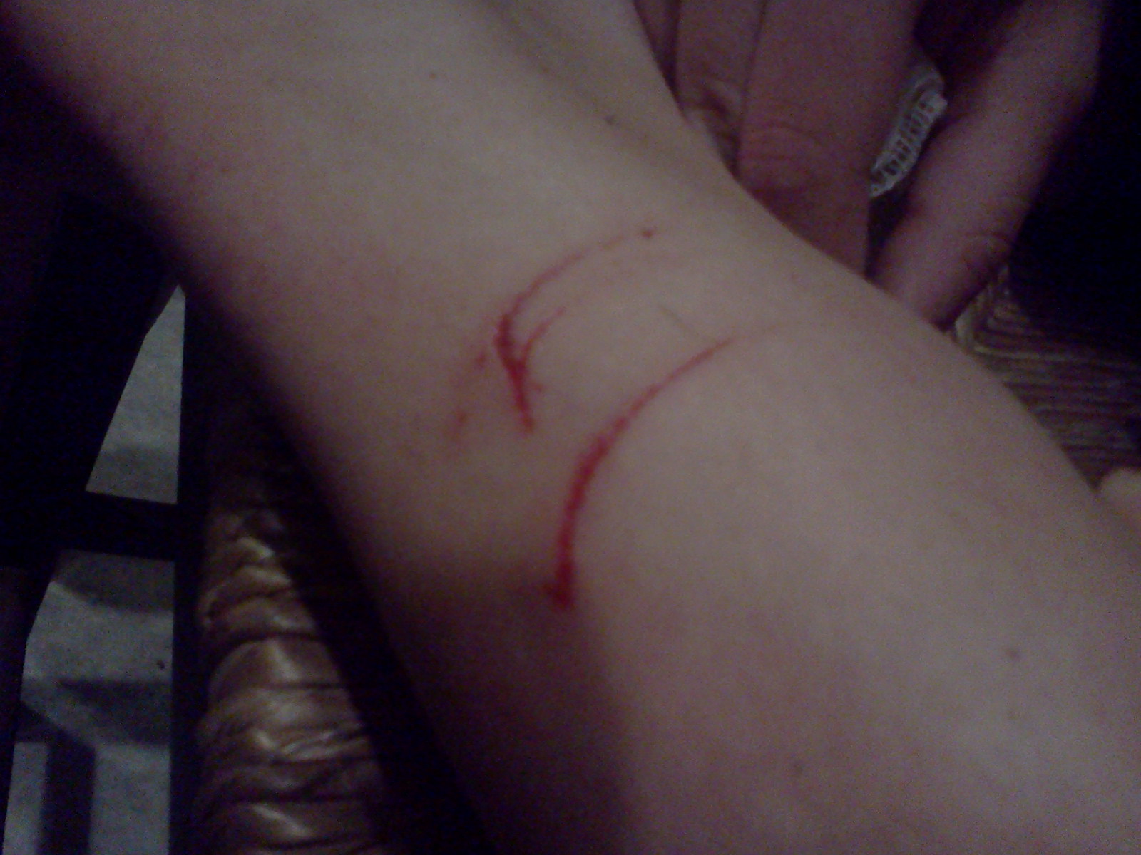 I Cut My Arm With A Razor