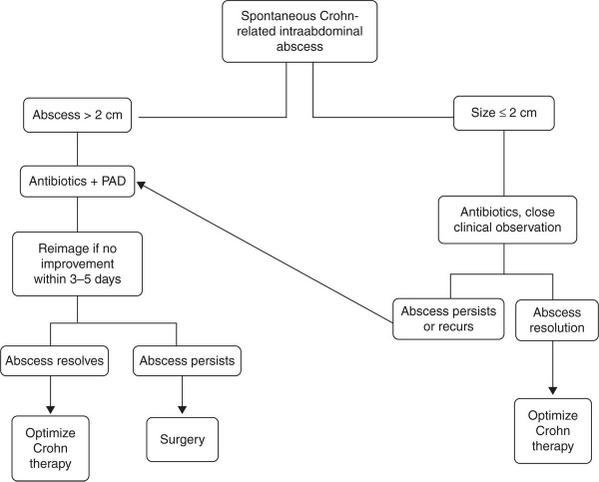 Anisocoria Flow Chart