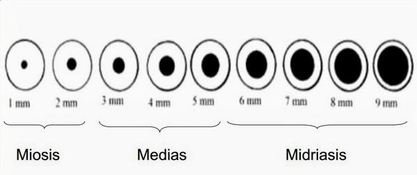 Miosis Vs Mydriasis