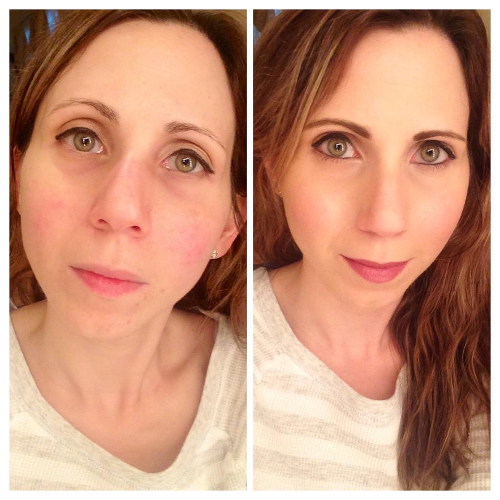 Prednisone Before And After