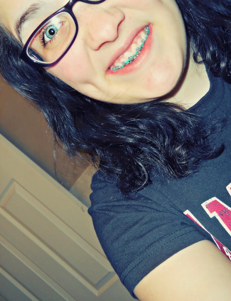 Girls With Braces On Twitter Blue Eyes And Blue Braces Braces