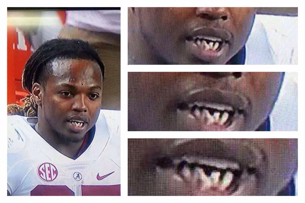 Celebrity TEETH: The Good, the Bad, and the Ugly | Page 8 | Lipstick Alley