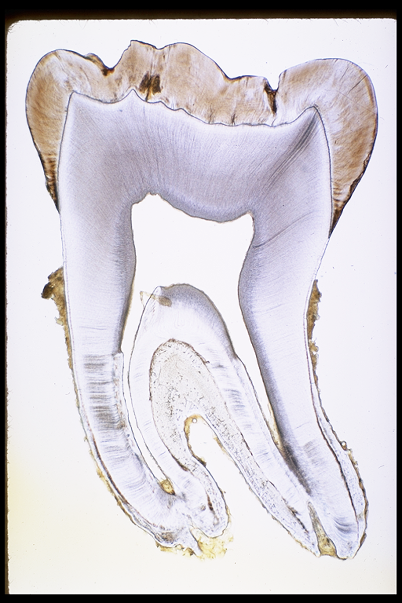 Molar Tooth Drawing