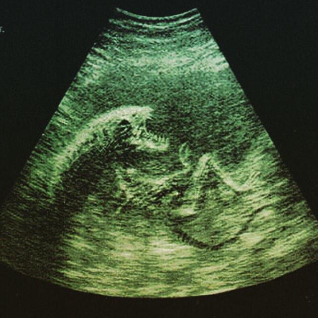 Alien Ultrasound Movie
