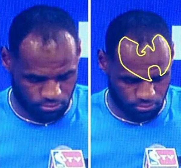 Lebron Hairline Before And After