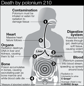 Polonium Poisoning