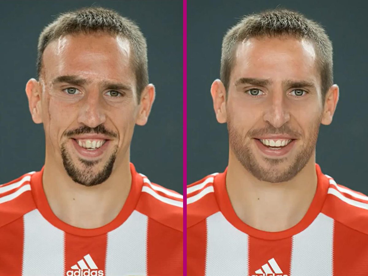 Franck Ribéry: Franck Ribéry avant/après #Photoshop : un résultat ...