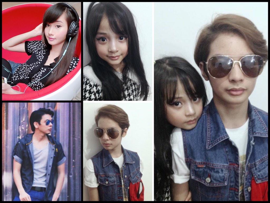 Alodia Gosiengfiao Before Surgery