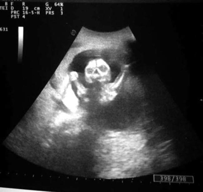 Alien Ultrasound