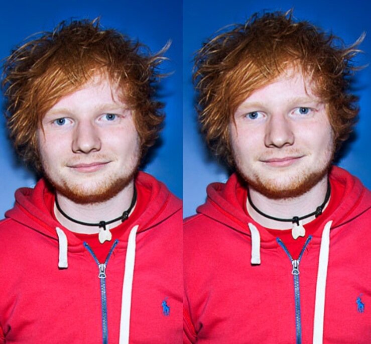 Ed Sheeran Before And Now