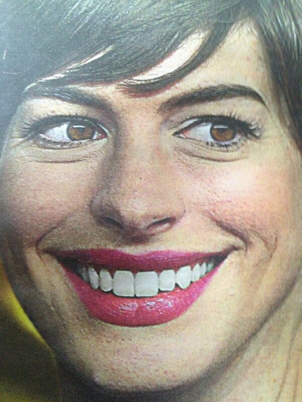 Anne Hathaway Teeth Missing