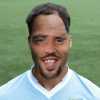 Ribery Teeth