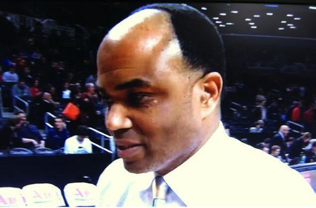 Worst Hairlines In Sports