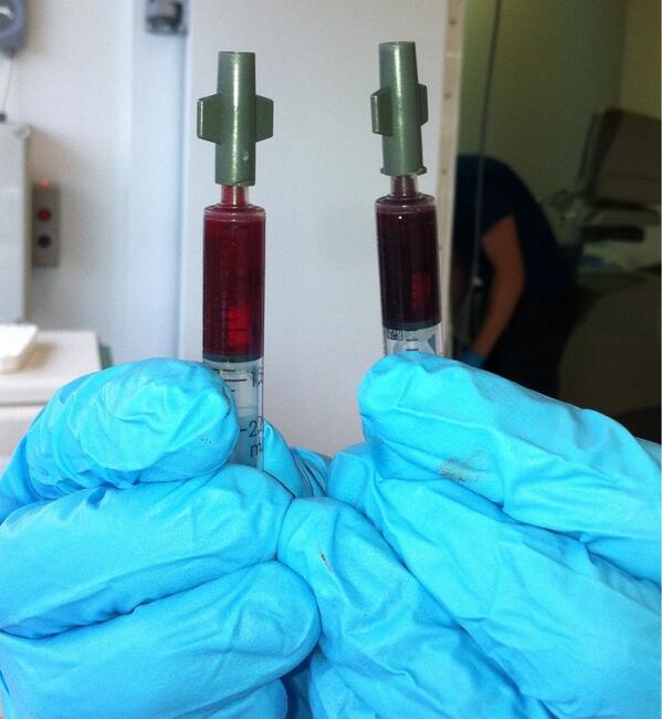 Arterial And Venous Blood