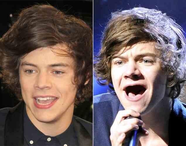 Harry Styles No Teeth