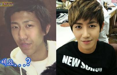Kwanghee Before Plastic Surgery