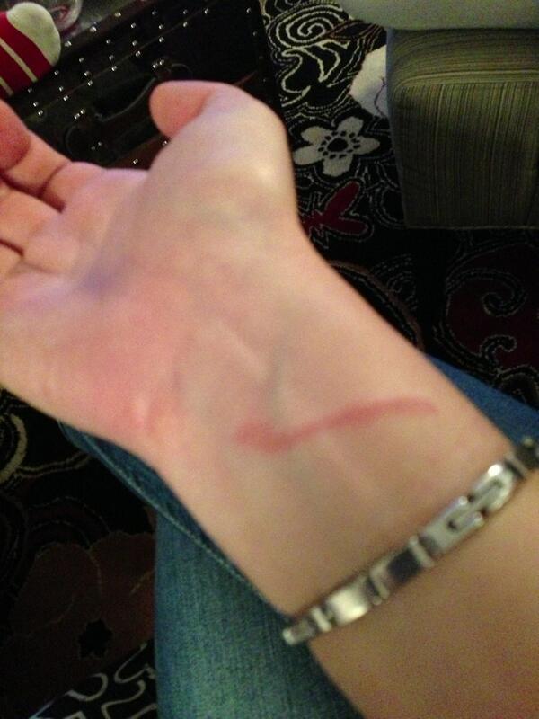 Wrist Cutting Pictures