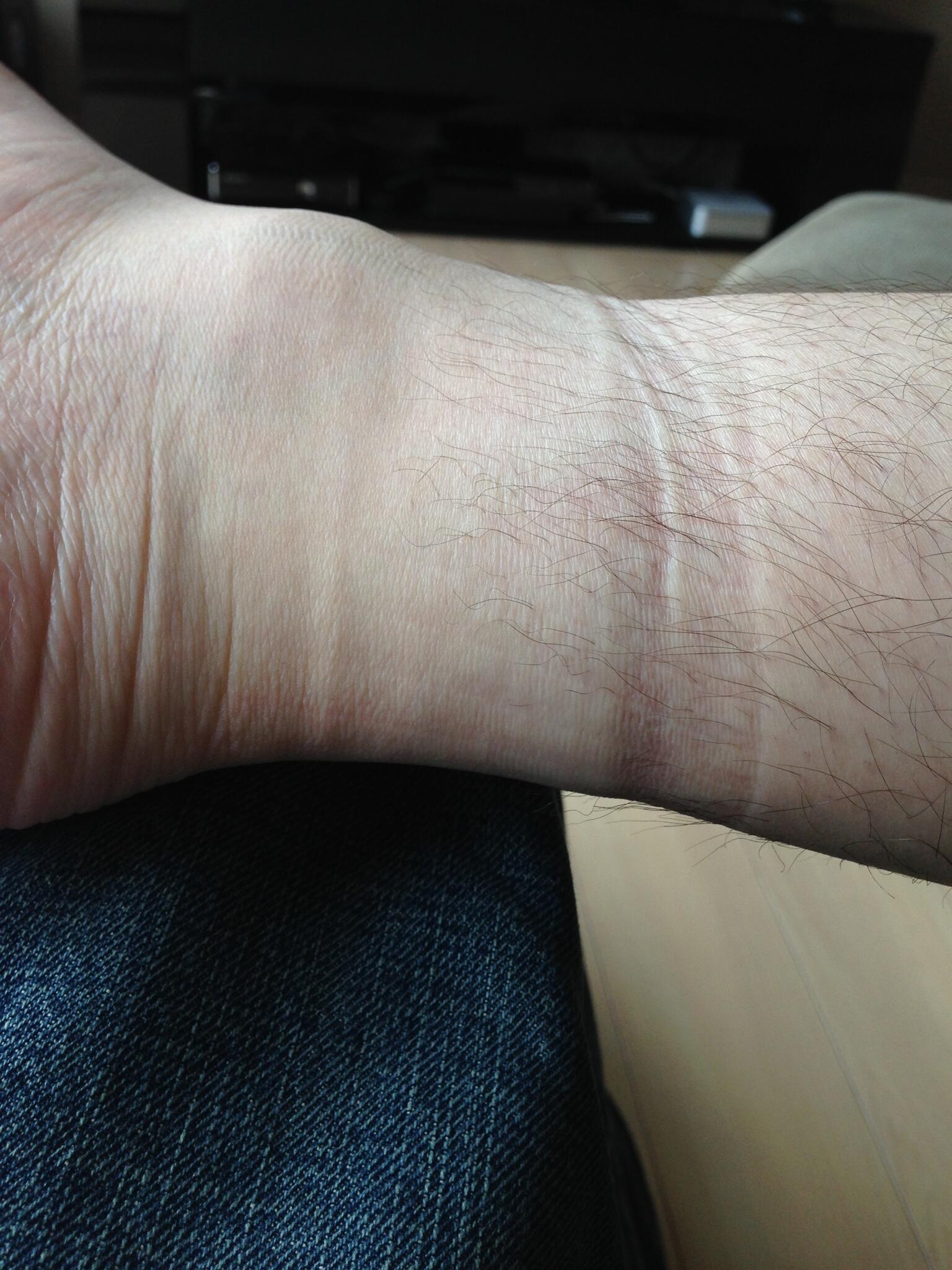 Socks too tight store