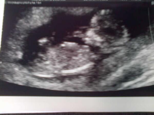 Simon Tricker (@simontricker) | Twitter