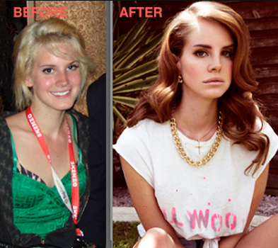 Lana Del Rey Before And After