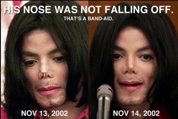 Michael Jackson Nose Collapse