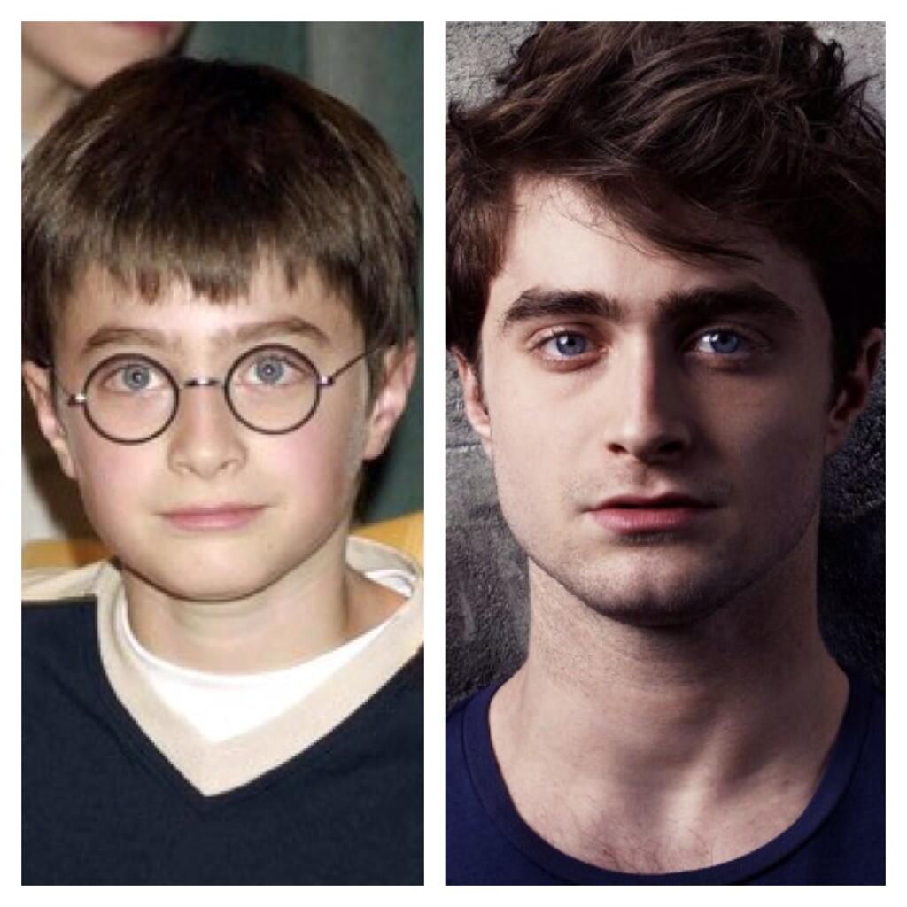 Daniel Radcliffe Before And After