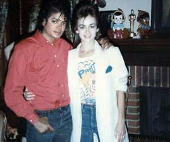 Michael Jackson Vitiligo Hands
