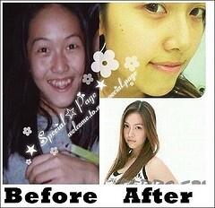Jessica Snsd Before And After