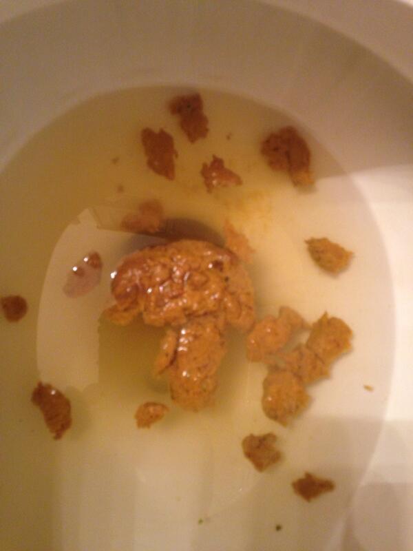 Threadworms In Stool