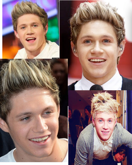 Before And After Braces Niall Horan