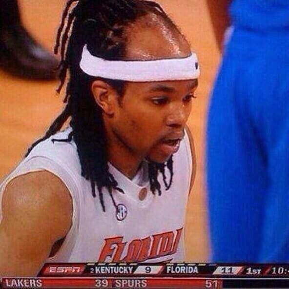 Basketball Player Receding Hairline at Leonel Muncy blog
