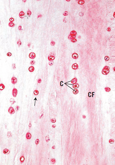 Fibrocartilage Diagram